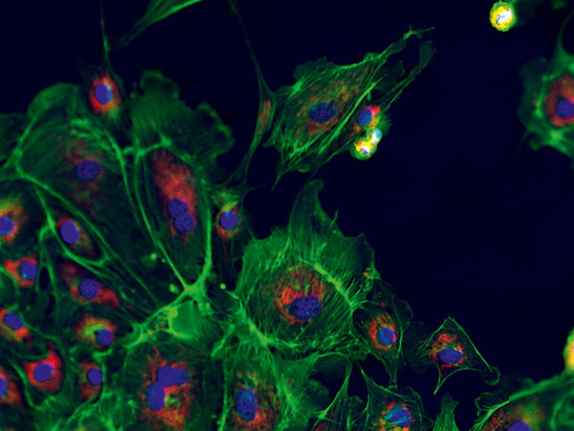 PCO’s sCMOS camera systems give science new focus – The New Economy