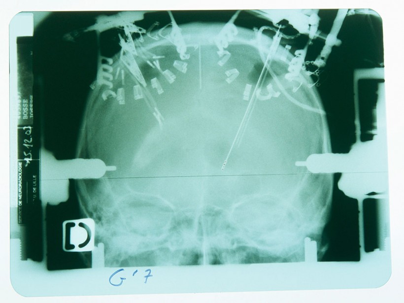 DARPA’s neural implant will make brain-computer interfacing a practical ...