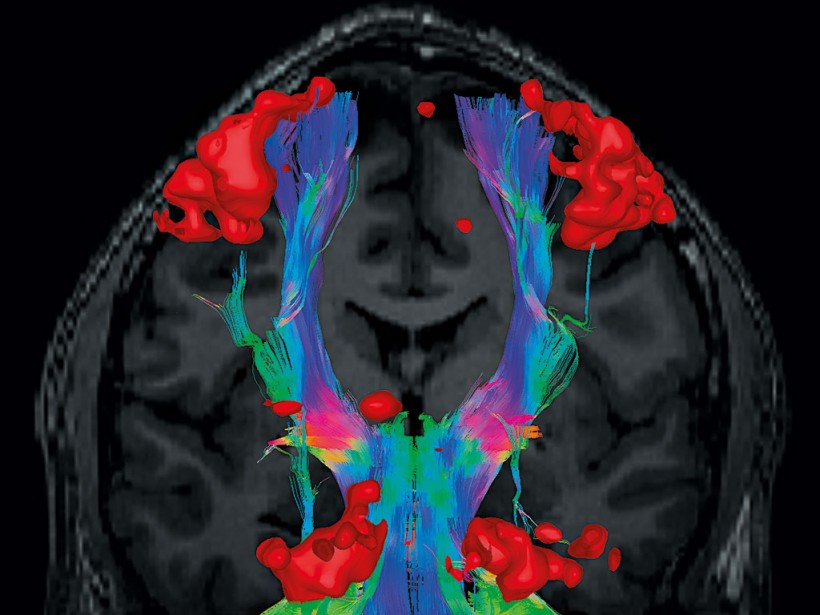 NordicNeuroLab transforms fMRI technology – The New Economy